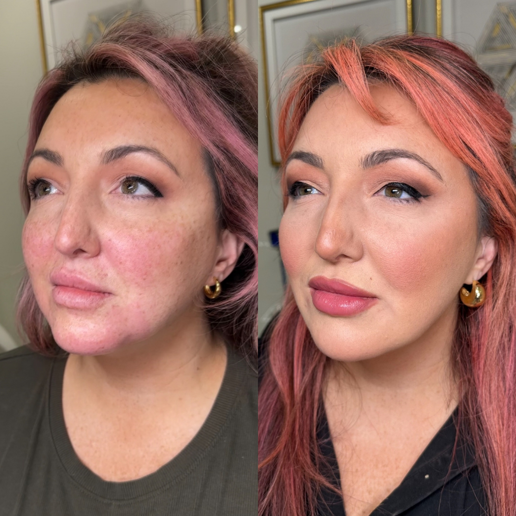 PRISM Aesthetics – PRISM Aesthetics